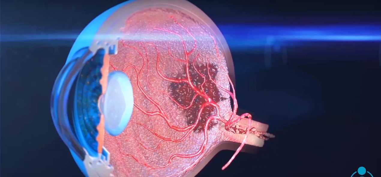 Medical Animation Studio - Nanobotmedical - professional animation