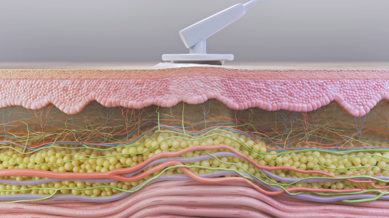 How 3D medical animation works in cosmetology